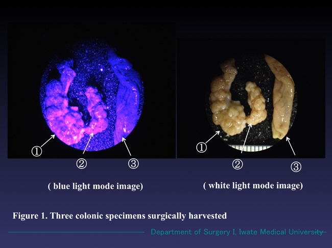 Clinical validity of our color-imaging histo-diagnosis for cancer